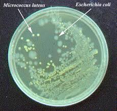 HOW TO ISOLATE A SINGLE COLONY
