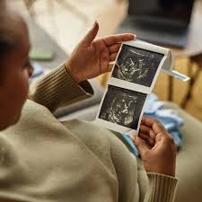 Progyny Inc (PGNY) Stock Price & News - Google Finance