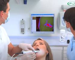 Camera trong miệng, camera nội soi răng miệng trong nha khoa là gì ...