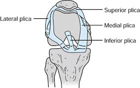 Patellar Plica – Something About Radiology – Just For Sharing