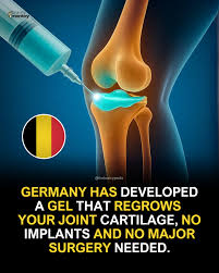 A Breakthrough in Joint Health: The Injectable Gel Revolutionizing ...