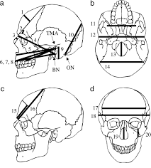 英和画像辞典：(bregma (region on human skull))の関連画像一覧！ – おもしろい英文法