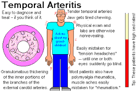 Temporal Arteritis - Jonathan Aarons MD/ Pain Management